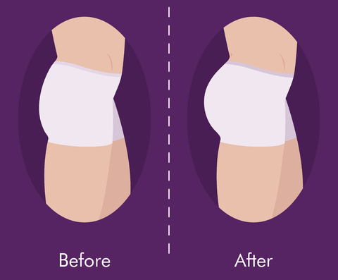 Buttock Implants for Men, BBL in Lima | Surgery in Peru