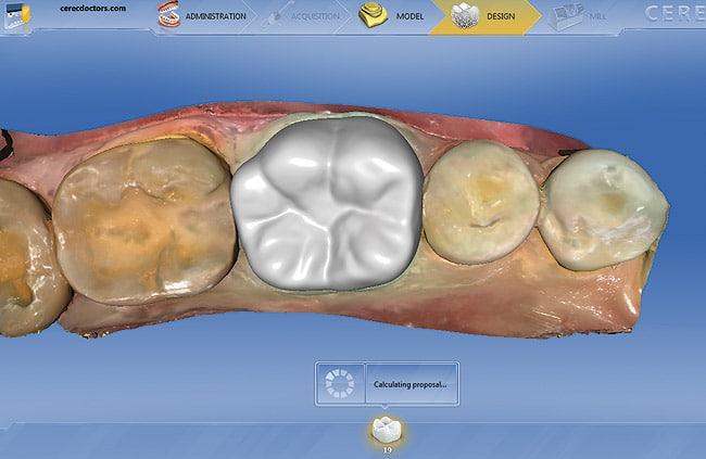 CEREC CAD CAM 3D en Lima Peru - Odontología 100% Digital