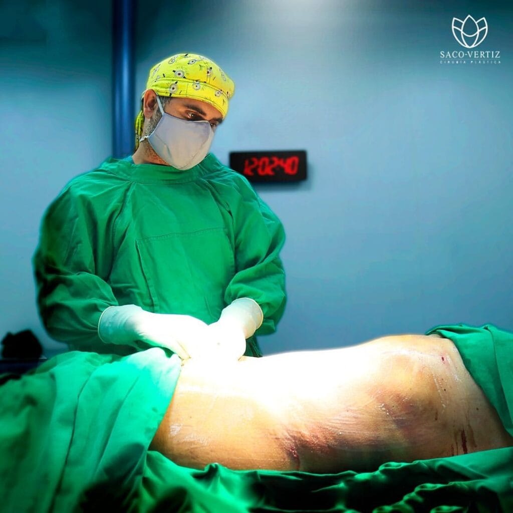 Panniculectomy in Lima | After Weight Loss Skin Removal